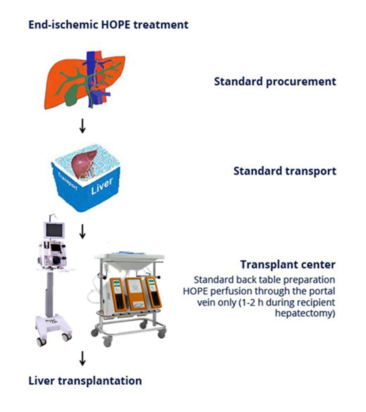 HOPE for the liver – Hypothermic Oxygenated liver PErfusion – USZ