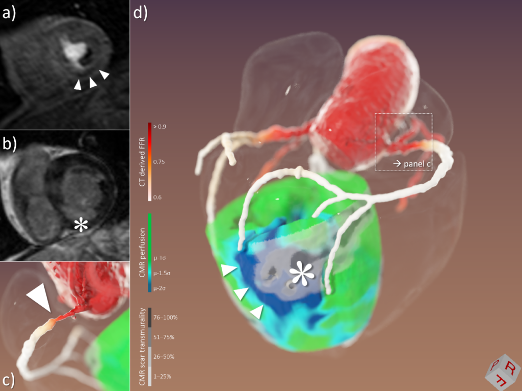 Cardiovascular Imaging Group – USZ