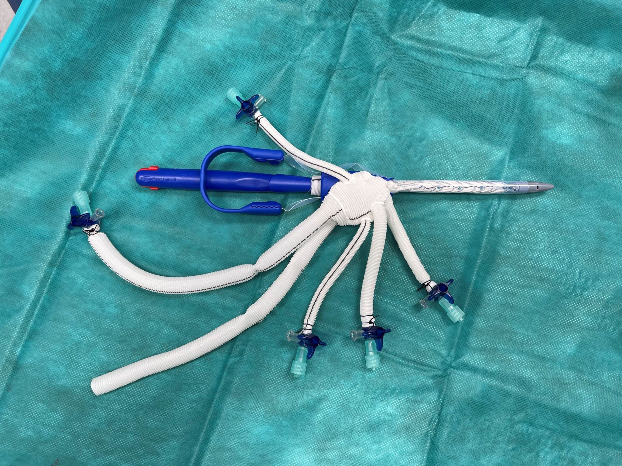 Aortenaneurysma: Neuartige Prothese für bisher inoperable Patienten – USZ