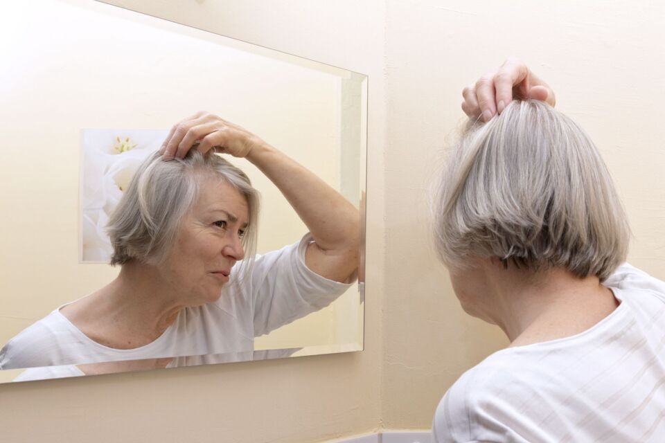 Hormonell bedingter Haarausfall – USZ