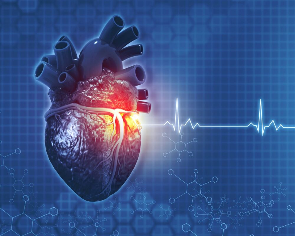 Sudden cardiac death – USZ