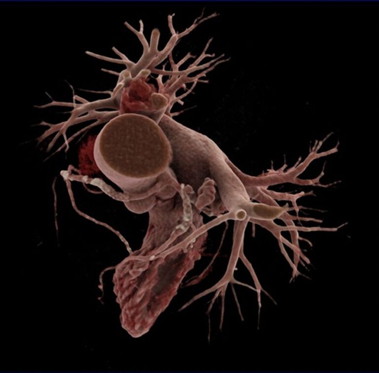 Grand Round Series in Cardiovascular Imaging – USZ